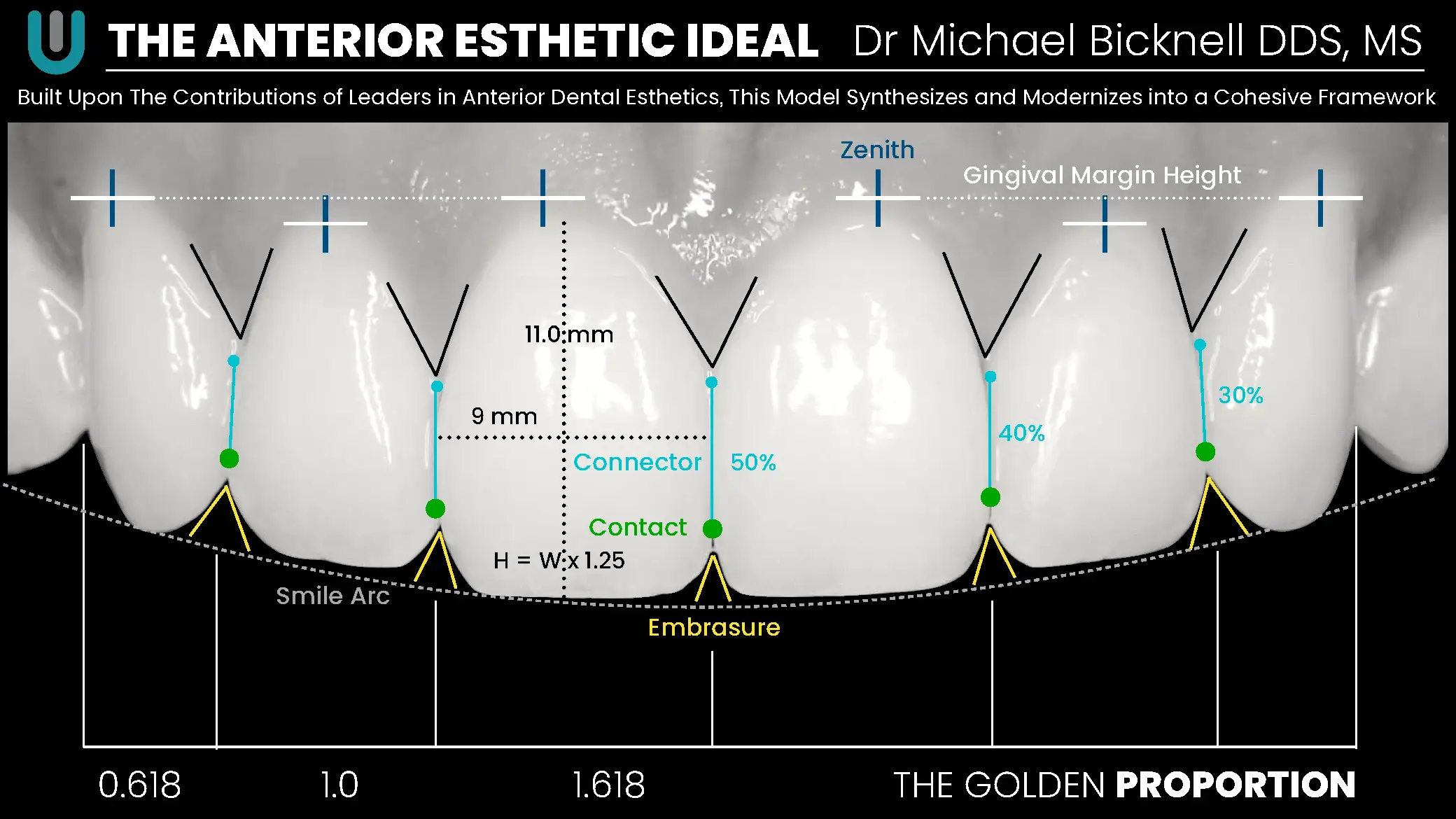 The Anterior Esthetic Ideal: Modern Principles for High-Definition ...